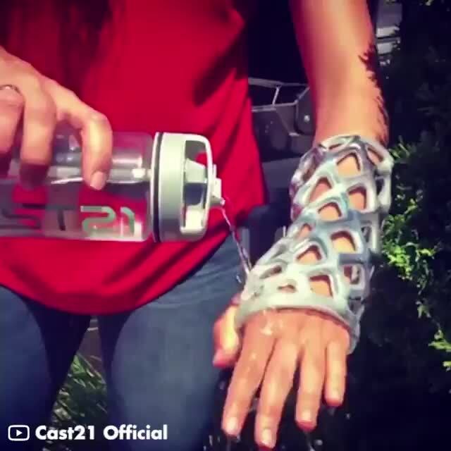 This futuristic “cast” is waterproof and comfortable to wear. Cast21 ...