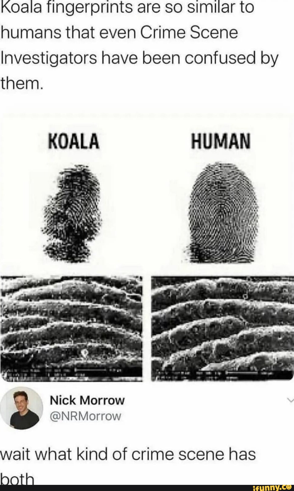 Tiny Tim married Miss Vicki Budinger on 'The Tonight Show' with million ...