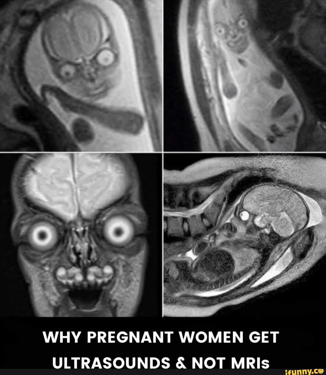 Ultrasound memes. Best Collection of funny Ultrasound pictures on iFunny