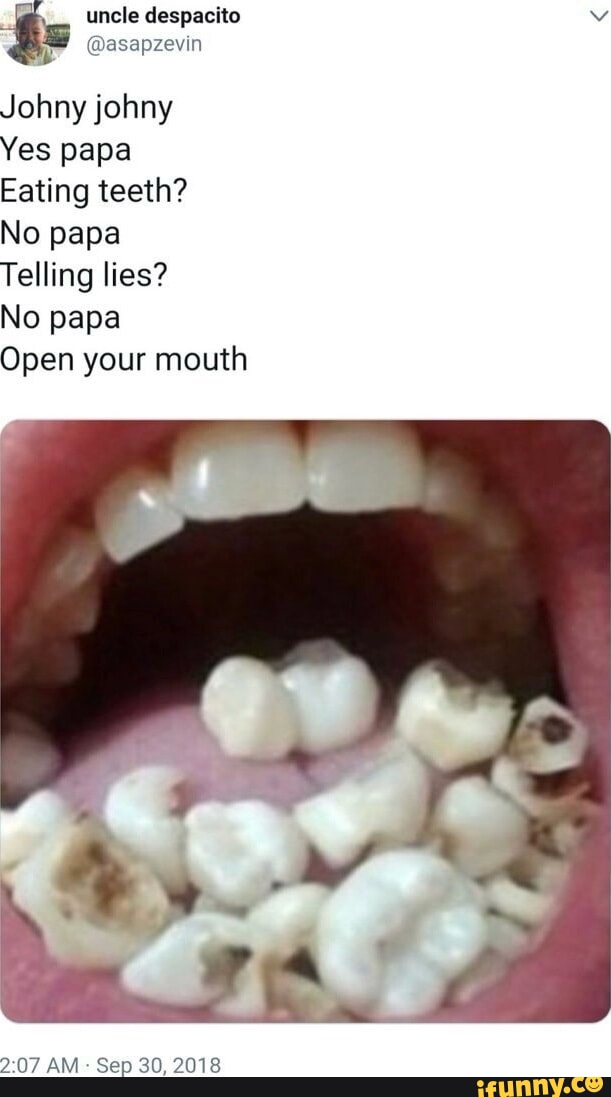 Uncle despacito Johny johny Yes papa Eating teeth? No papa Telling lies ...