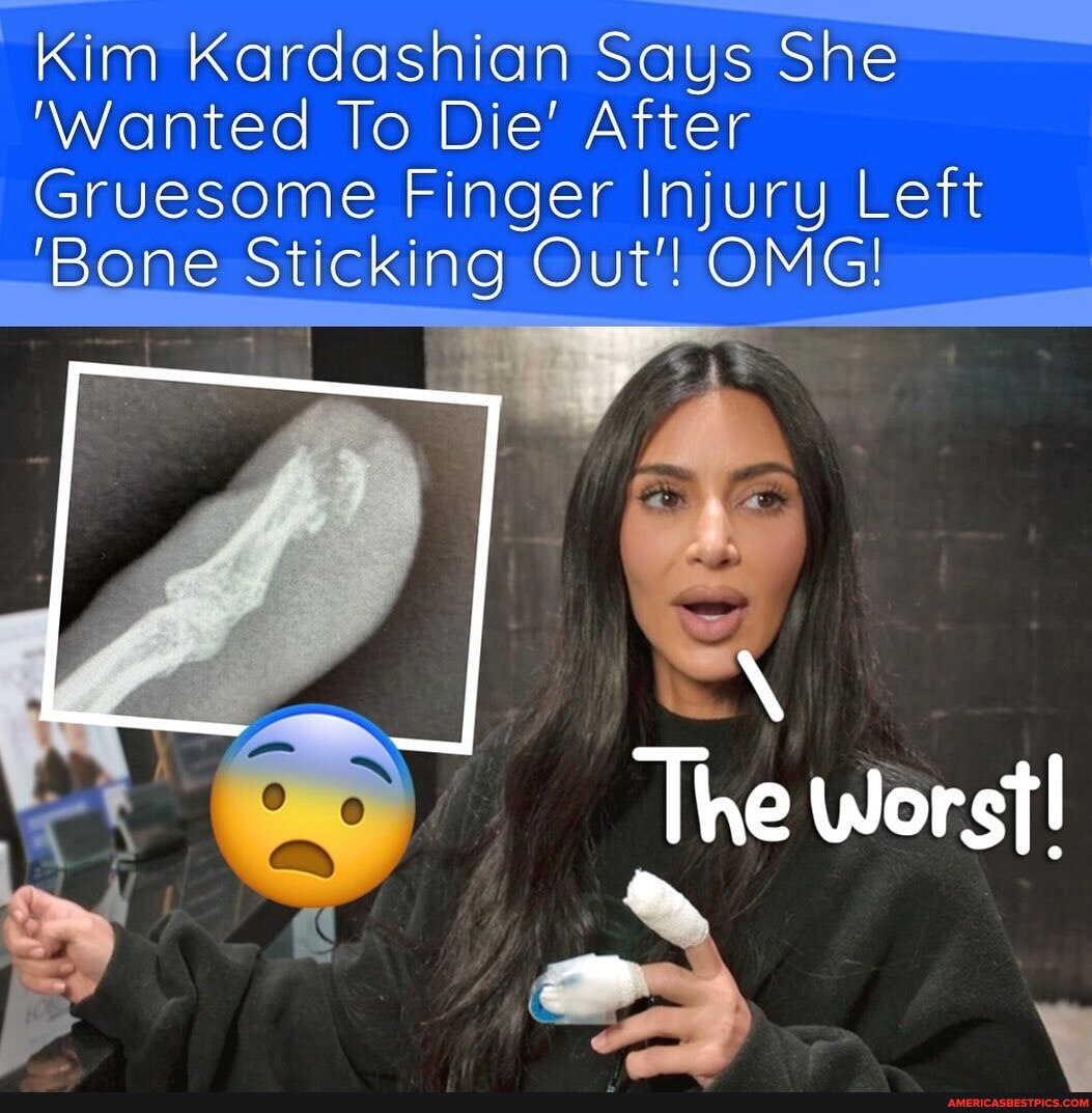 Kim Kardashian Says She 'Wanted To Die' After Gruesome Finger Injury ...