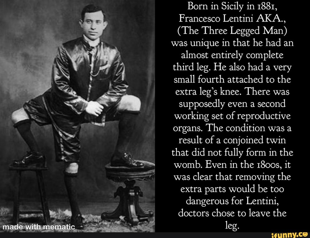 Born in Sicily in 1881, Francesco Lentini AKA., (The Three Legged Man ...