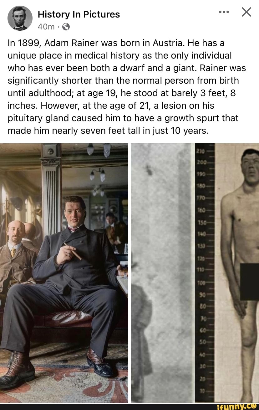 History In Pictures In 1899, Adam Rainer was born in Austria. He has a ...