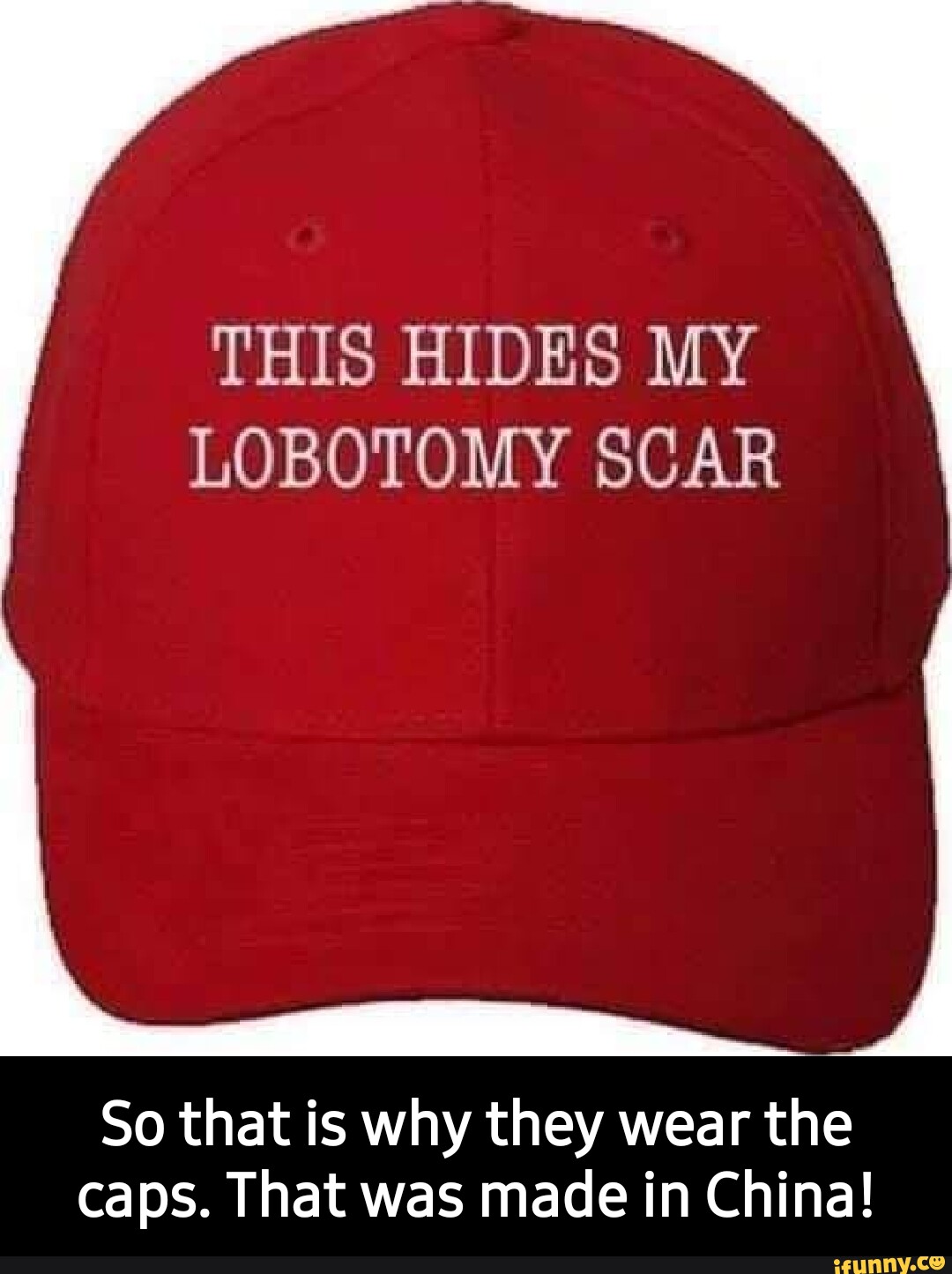 THIS HIDES MY LOBOTOMY SCAR So that is why they wear the caps. That was ...