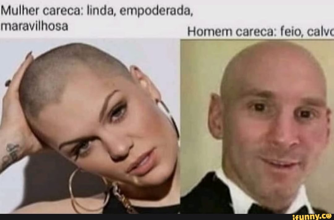 Mulher careca: linda, empoderada, maravilhosa Homem careca: feio, calve ...
