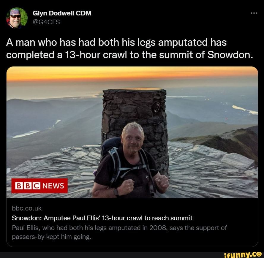 Amputee memes. Best Collection of funny Amputee pictures on iFunny