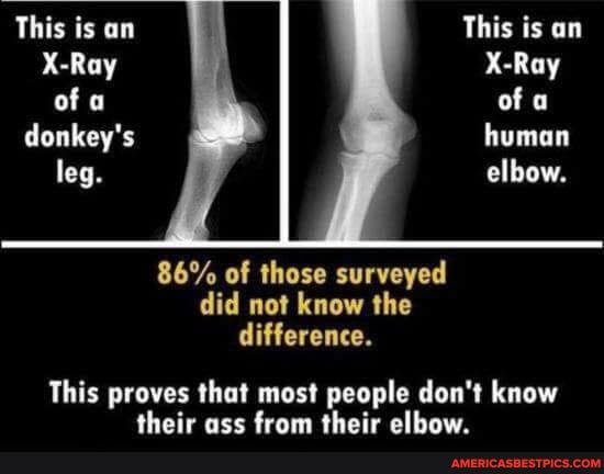 Know your donkey - This is an This is an X-Ray X-Ray of of a donkey's ...