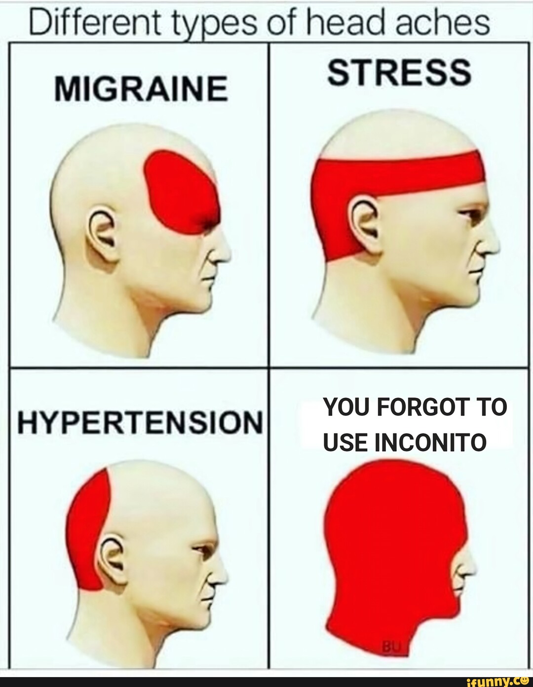 Different types of head aches MIGRAINE STRESS HYPERTENSION YOU FORGOT ...