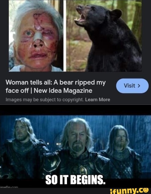 Woman tells all: A bear ripped my face off I New Idea Magazine Images ...