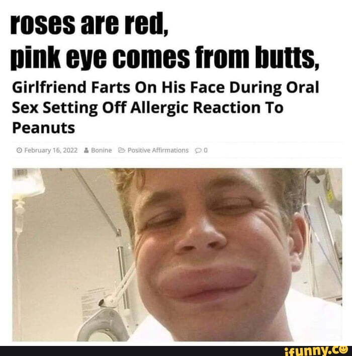 Roses Are Red Dink Eye Comes From Butts Girlfriend Farts On His Face During Oral Sex Setting
