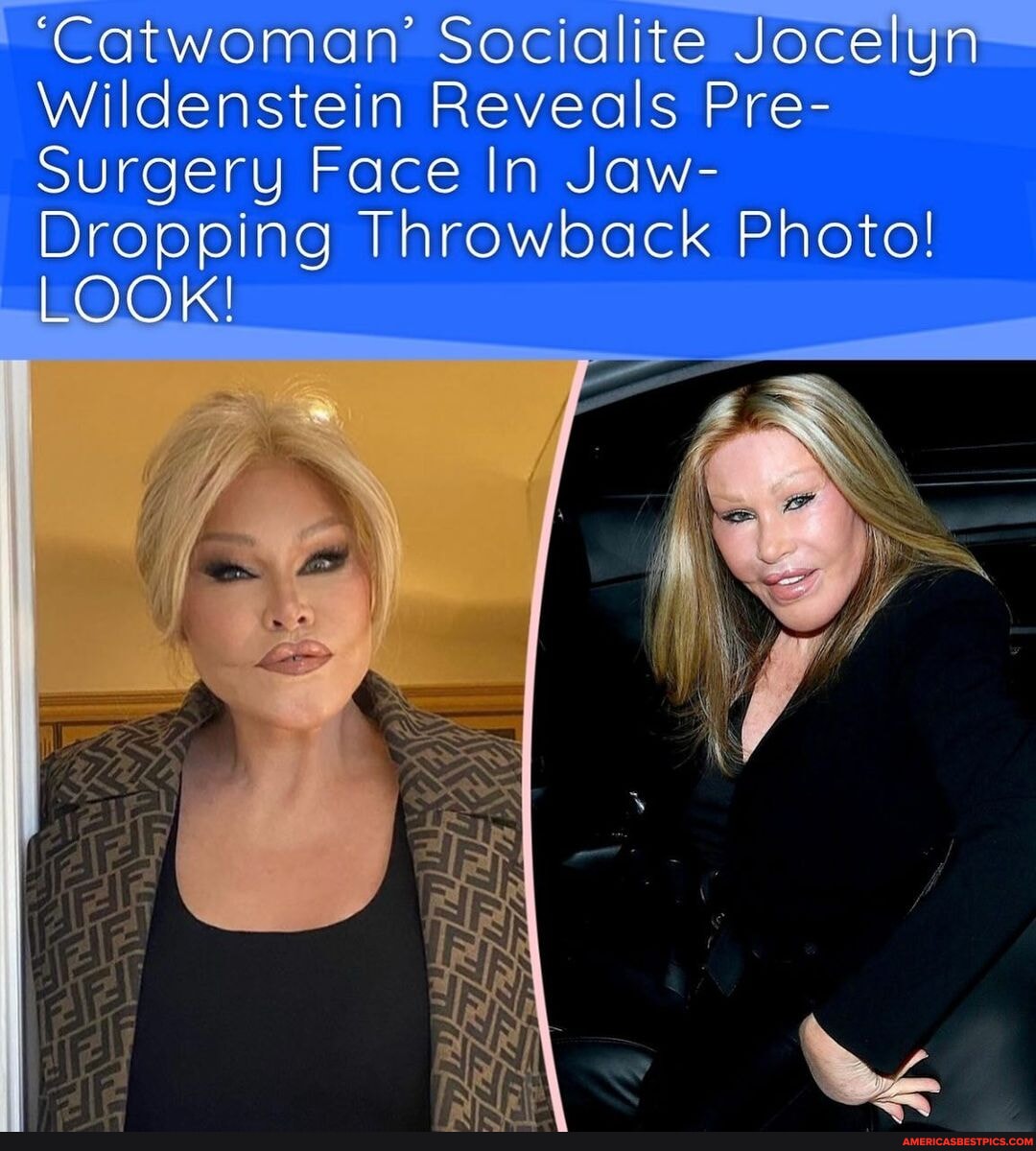 'Catwoman Socialite Jocelyn Wildenstein Reveals Pre Surgery Face In Jaw ...