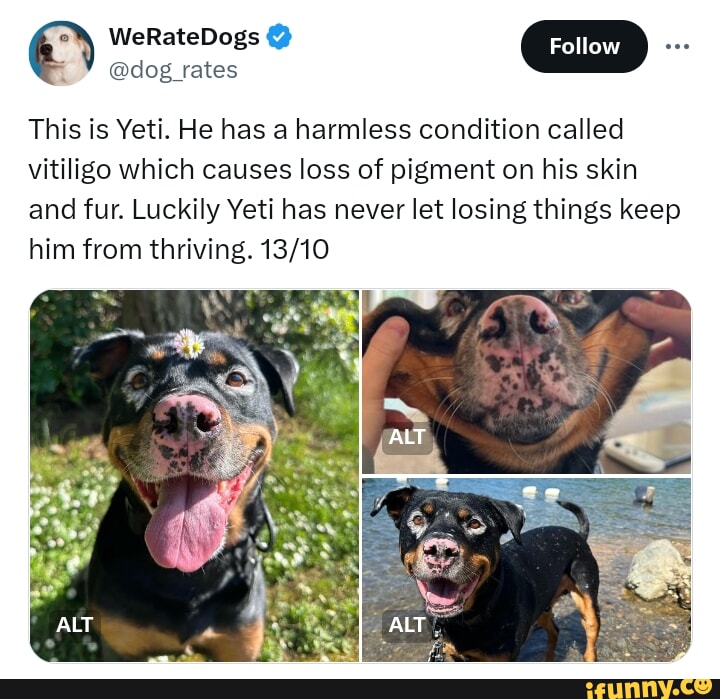 Vitiligo memes. Best Collection of funny Vitiligo pictures on iFunny