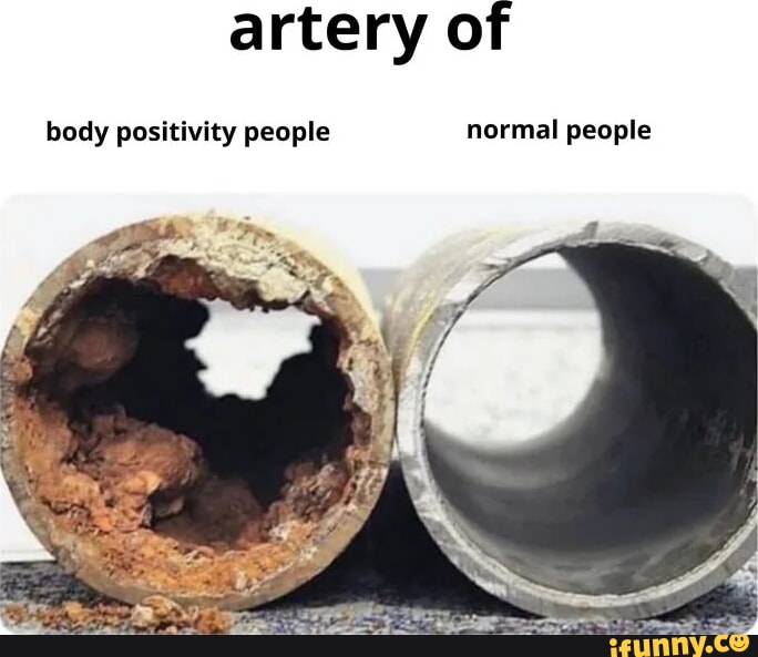 Artery of body positivity people normal people - iFunny