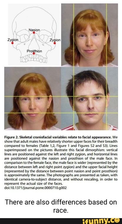 Craniofacial memes. Best Collection of funny Craniofacial pictures on ...