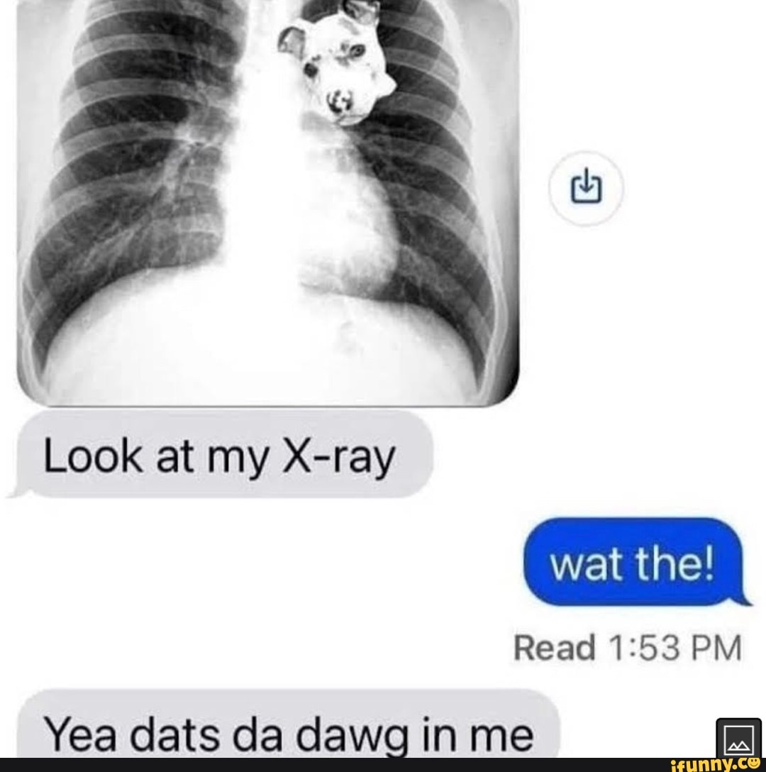 Look at my X-ray wat tine! Read PM Yea dats da dawg in me I - iFunny