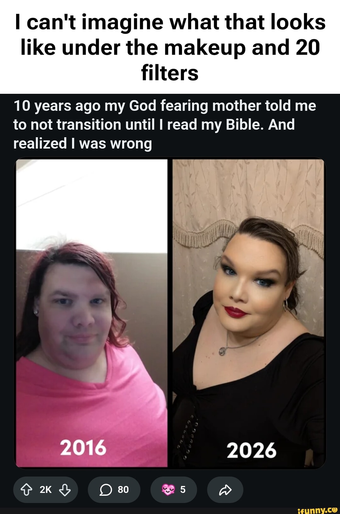 I can't imagine what that looks like under the makeup and 20 filters 10 ...