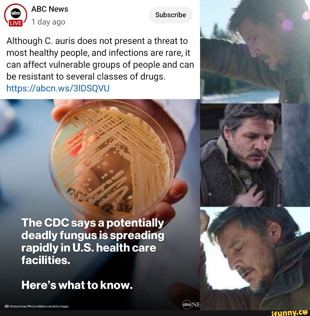 Auris memes. Best Collection of funny Auris pictures on iFunny