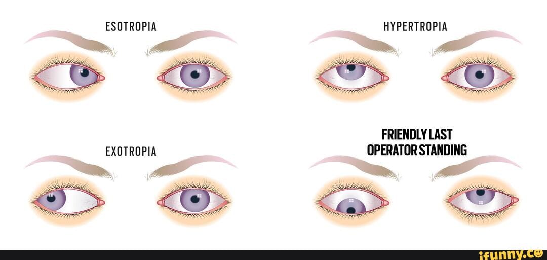 Strabismus memes. Best Collection of funny Strabismus pictures on iFunny
