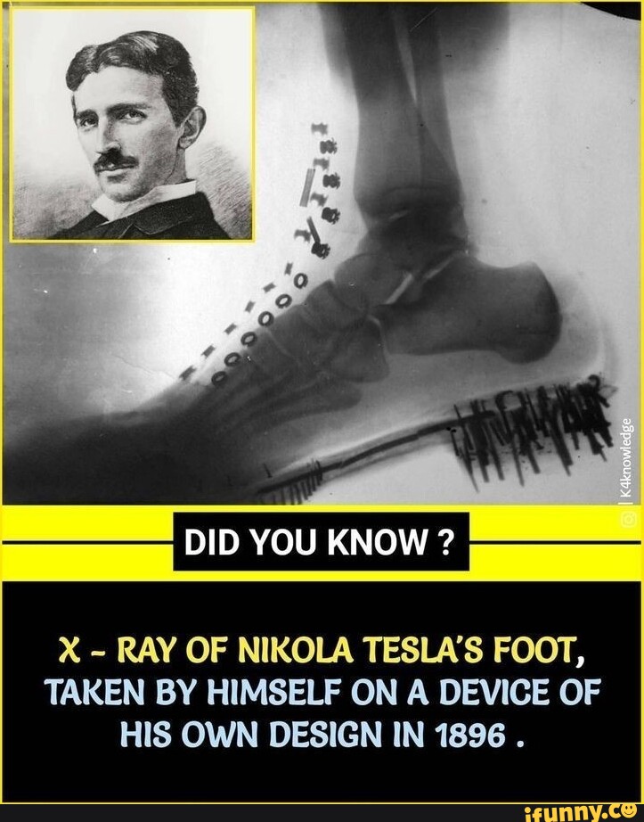DID YOU KNOW ? X RAY OF NIKOLA TESLA'S FOOT, TAKEN BY HIMSELF ON A ...