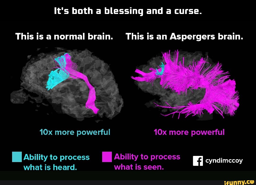 It's both a blessing and a curse. This is anormal brain. This is an ...