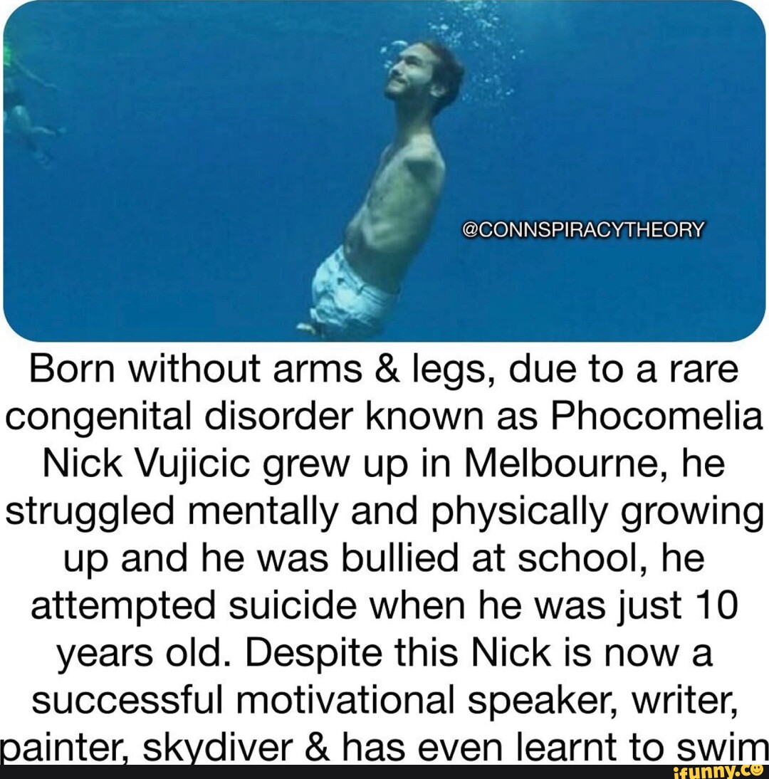 CONNSPIRACY THEORY Born without arms & legs, due to a rare congenital ...