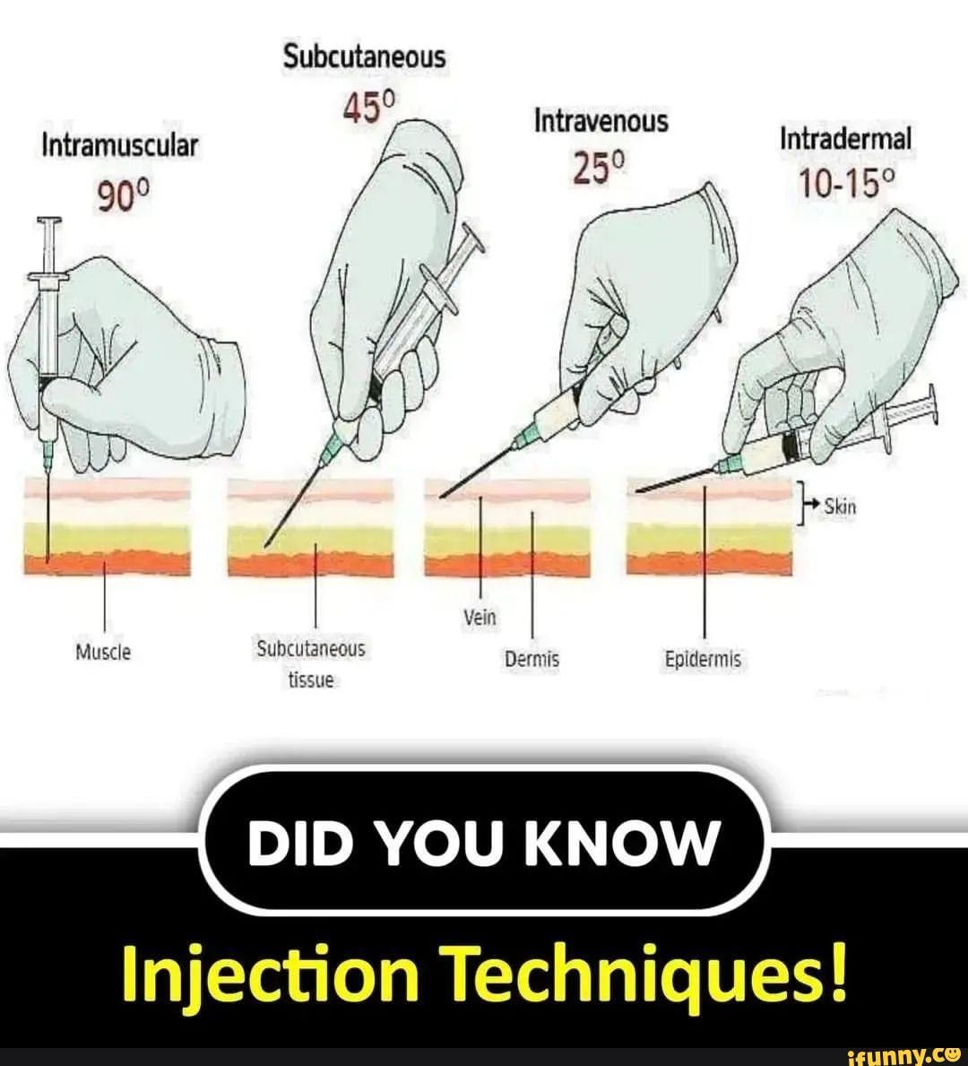 Subcutaneous 45 Intravenous Intradermal 10-1 Intramuscular Muscle ...