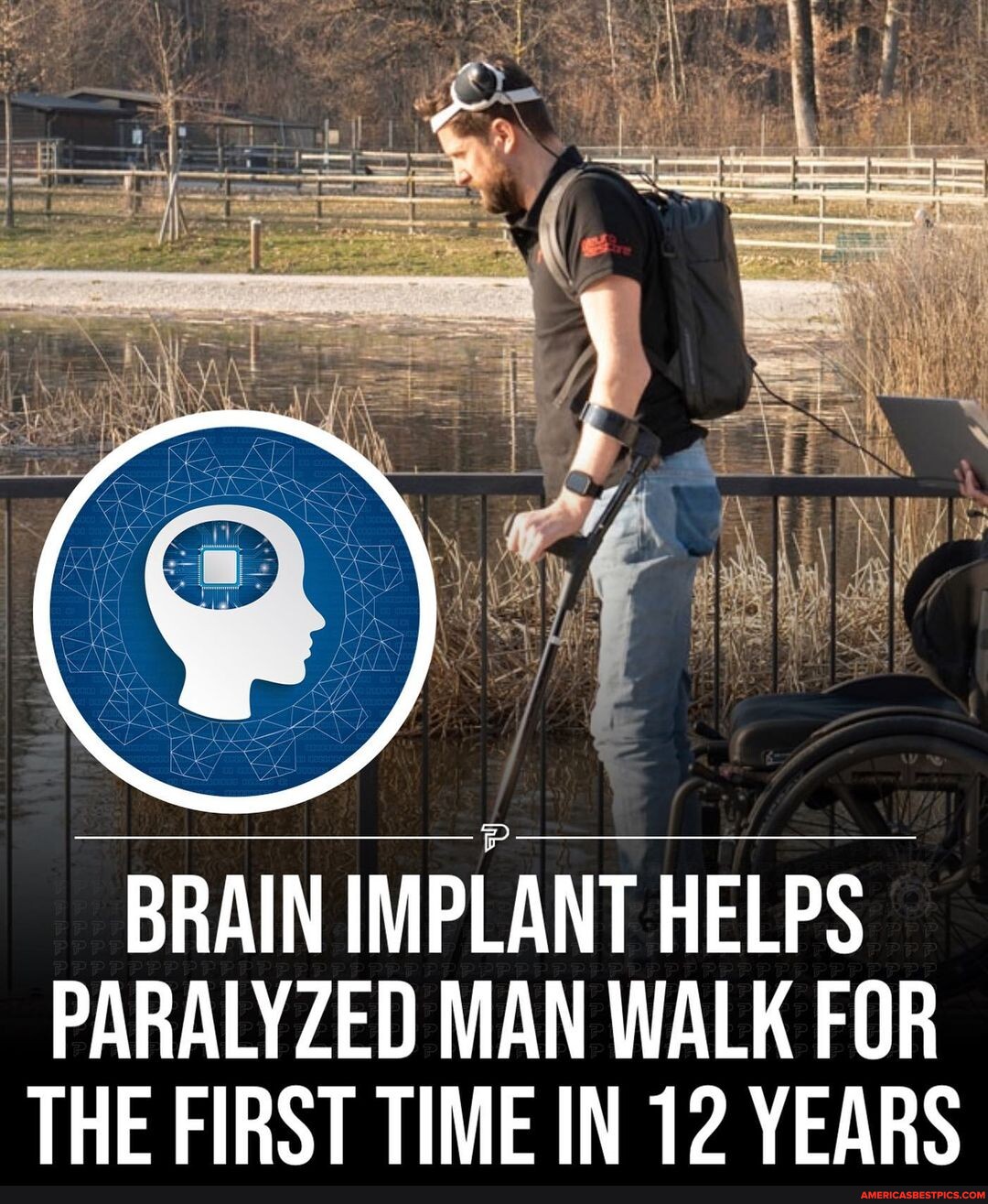 A 40-year-old man with paralyzed legs is now able to walk, climb stairs ...