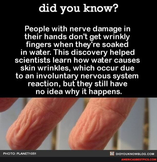 Did you know? People with nerve damage in their hands don't get wrinkly ...