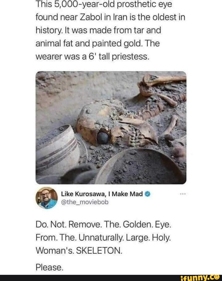 Prosthetic memes. Best Collection of funny Prosthetic pictures on iFunny