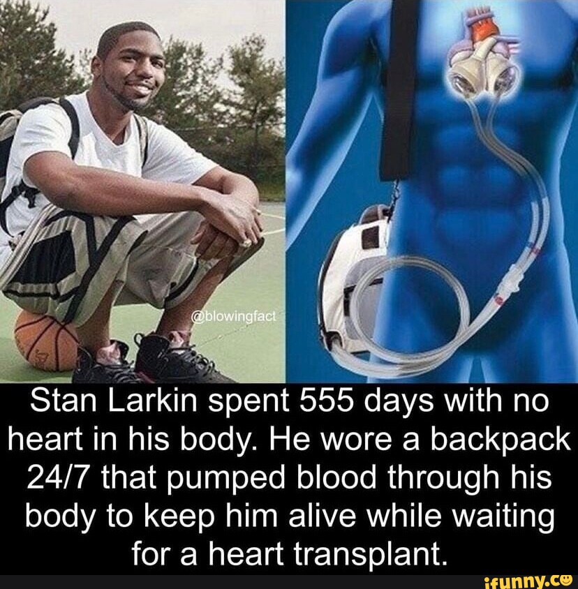 Stan Larkin spent 555 days with no heart in his body. He wore a ...