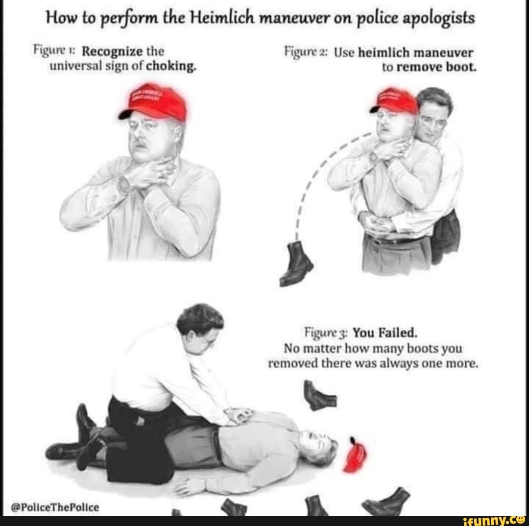 How to perform the Heimlich maneuver on police apologists Figure ...
