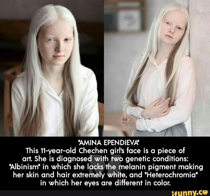 This 11-year-old Chechen girl's face is a piece of art. She is ...