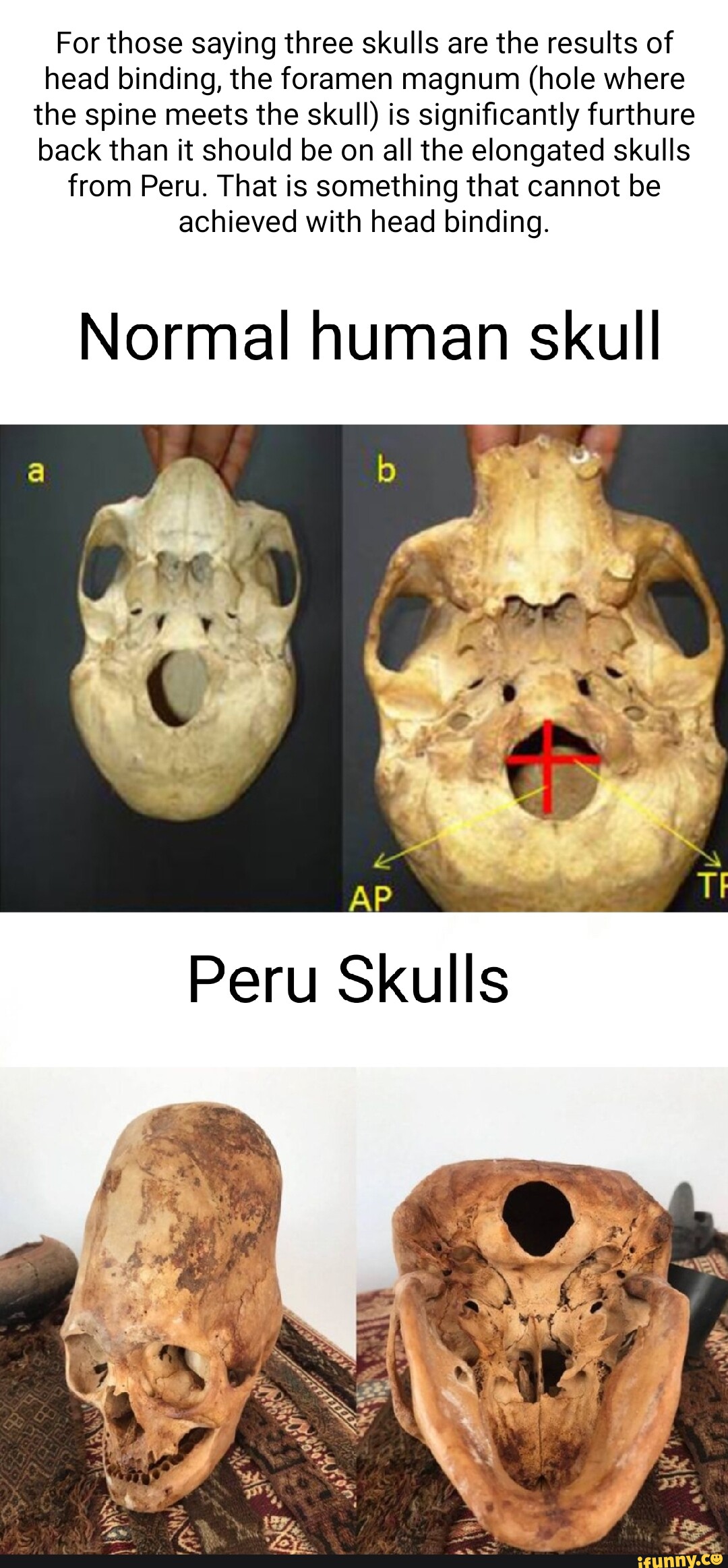 For those saying three skulls are the results of head binding, the ...