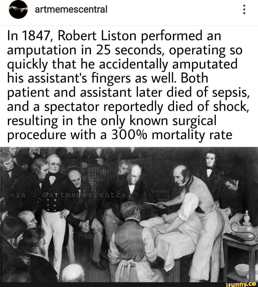 The good ol' days - In 1847, Robert Liston performed an amputation in ...