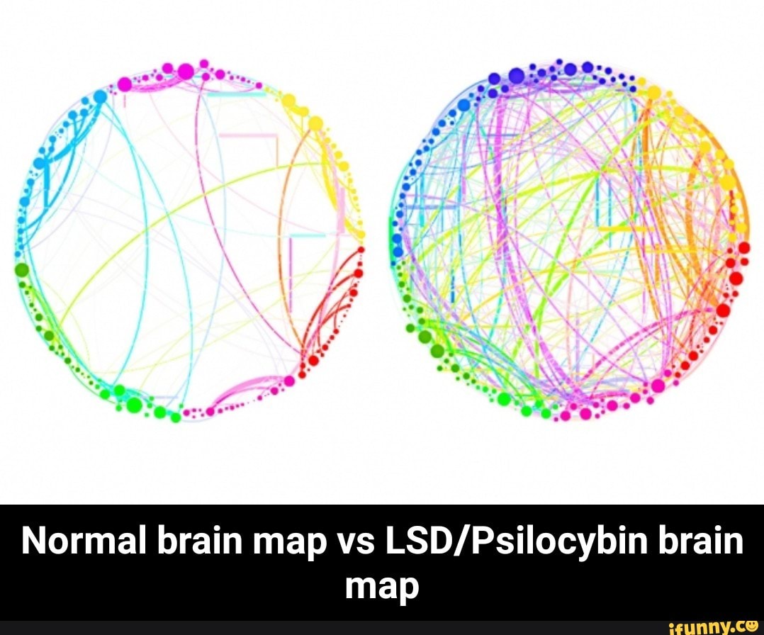Brain map vs LSD/Psilocybin brain map Normal - Normal brain map vs LSD ...