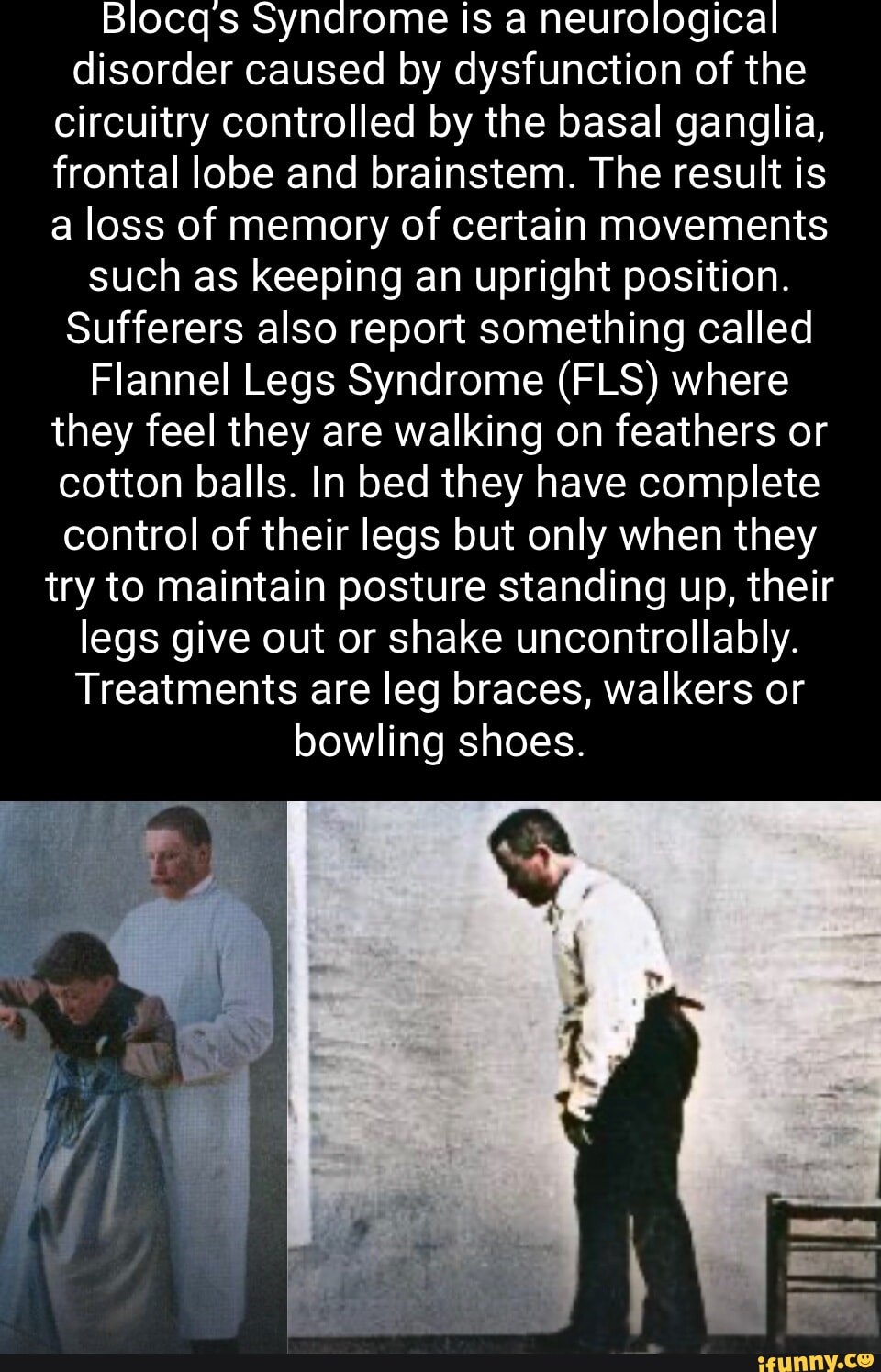 Blocqs Syndrome is a neurological disorder caused by dysfunction of the ...