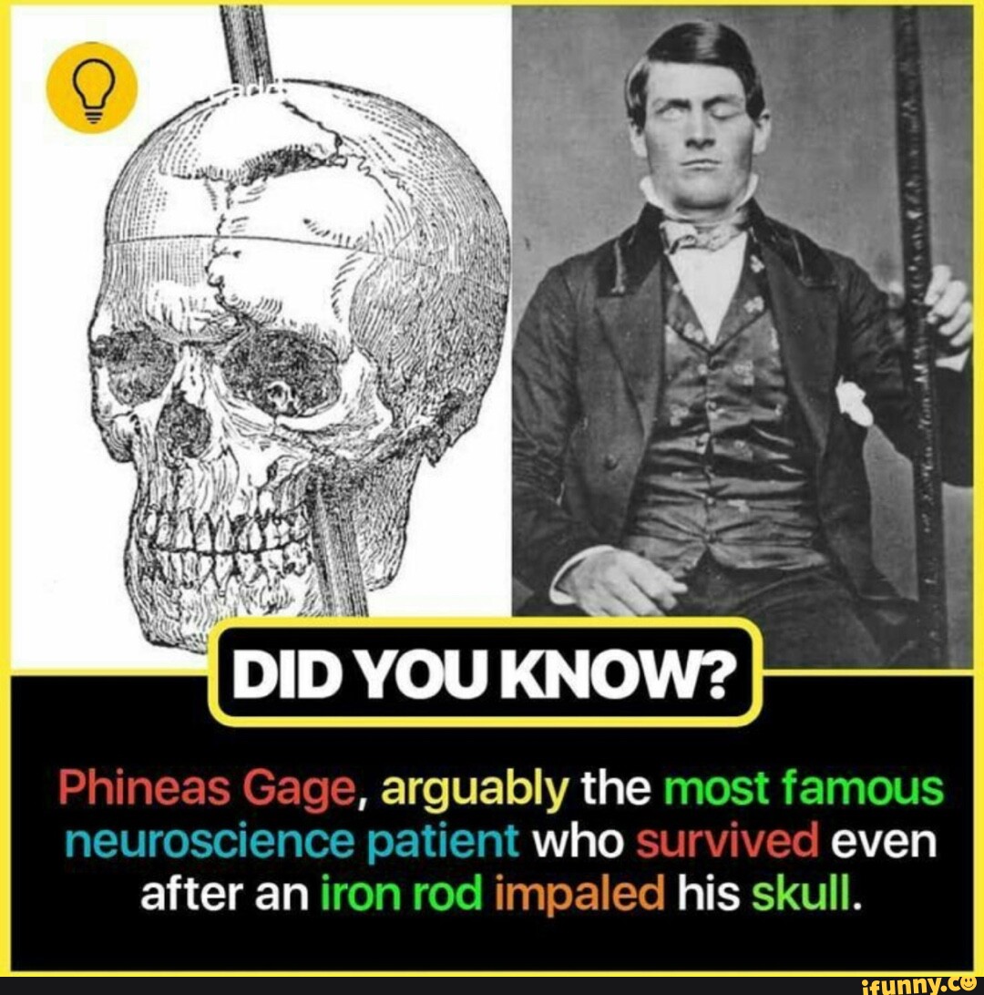 DID YOU KNOW? Phineas , arguably the most famous neuroscience patient ...