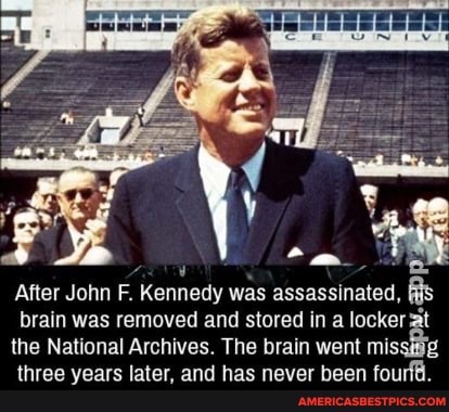 Cm ER After John F. Kennedy was assassinated, brain was removed and ...
