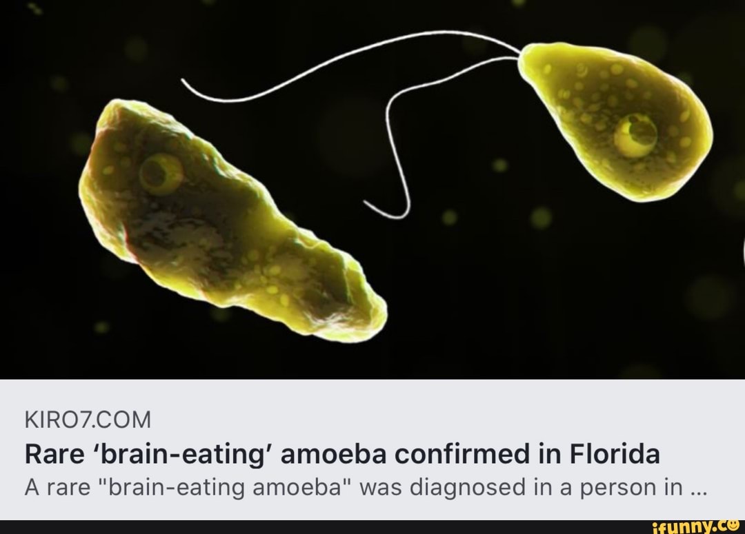 KIRO7.COM Rare 'brain-eating' amoeba confirmed in Florida A rare "brain ...