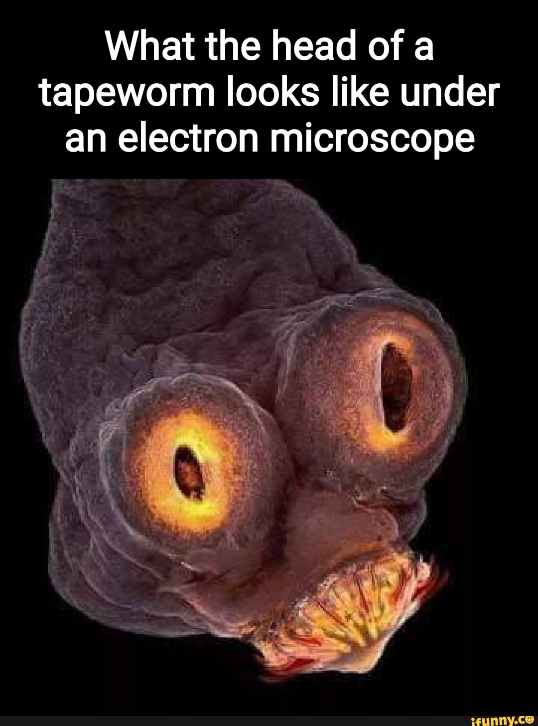 What the head of a tapeworm looks like under an electron microscope ...