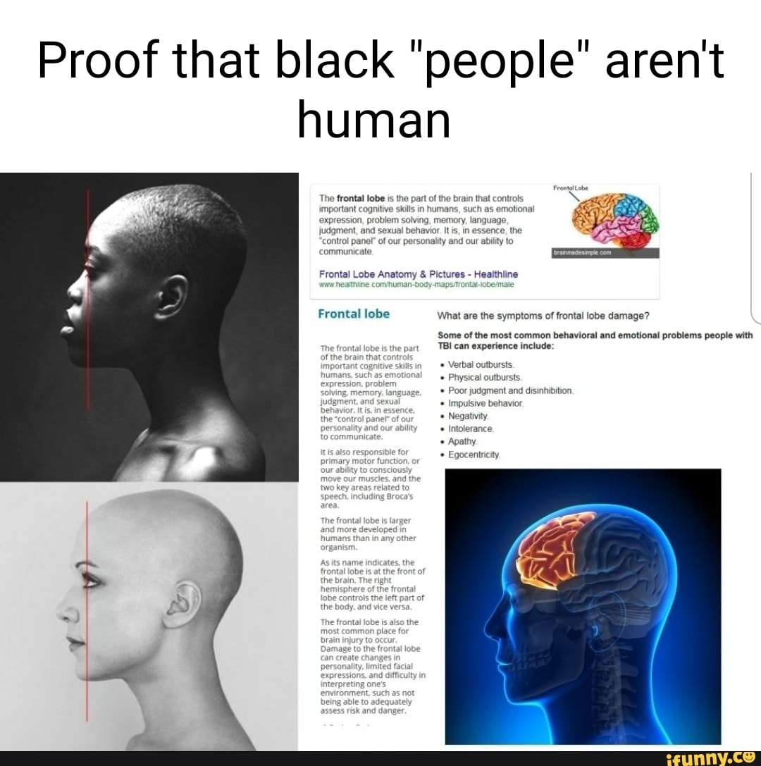 Roof that black "people" aren't human The frontal lobe is the part of ...