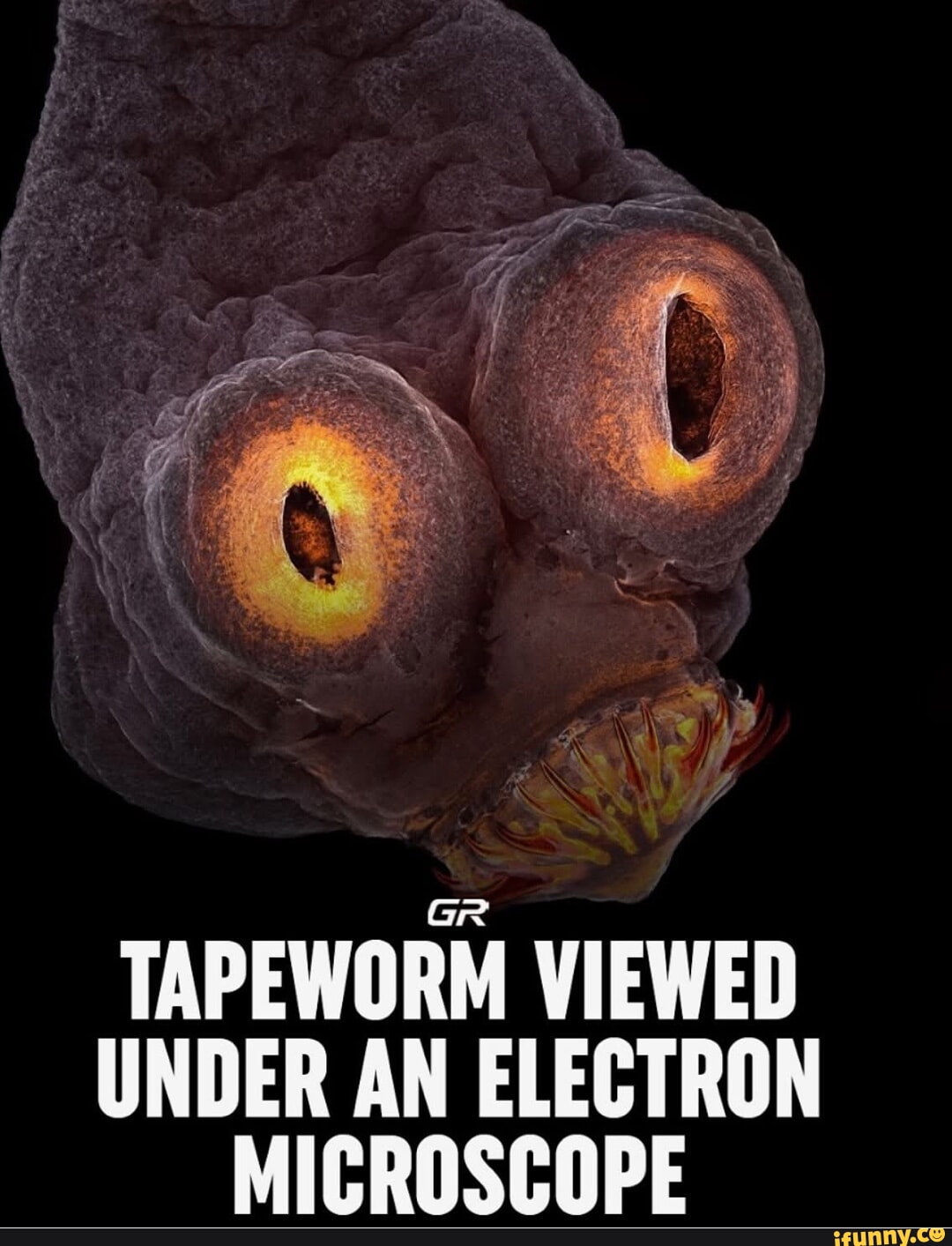 TAPEWORM VIEWED UNDER AN ELECTRON MICROSCOPE - iFunny