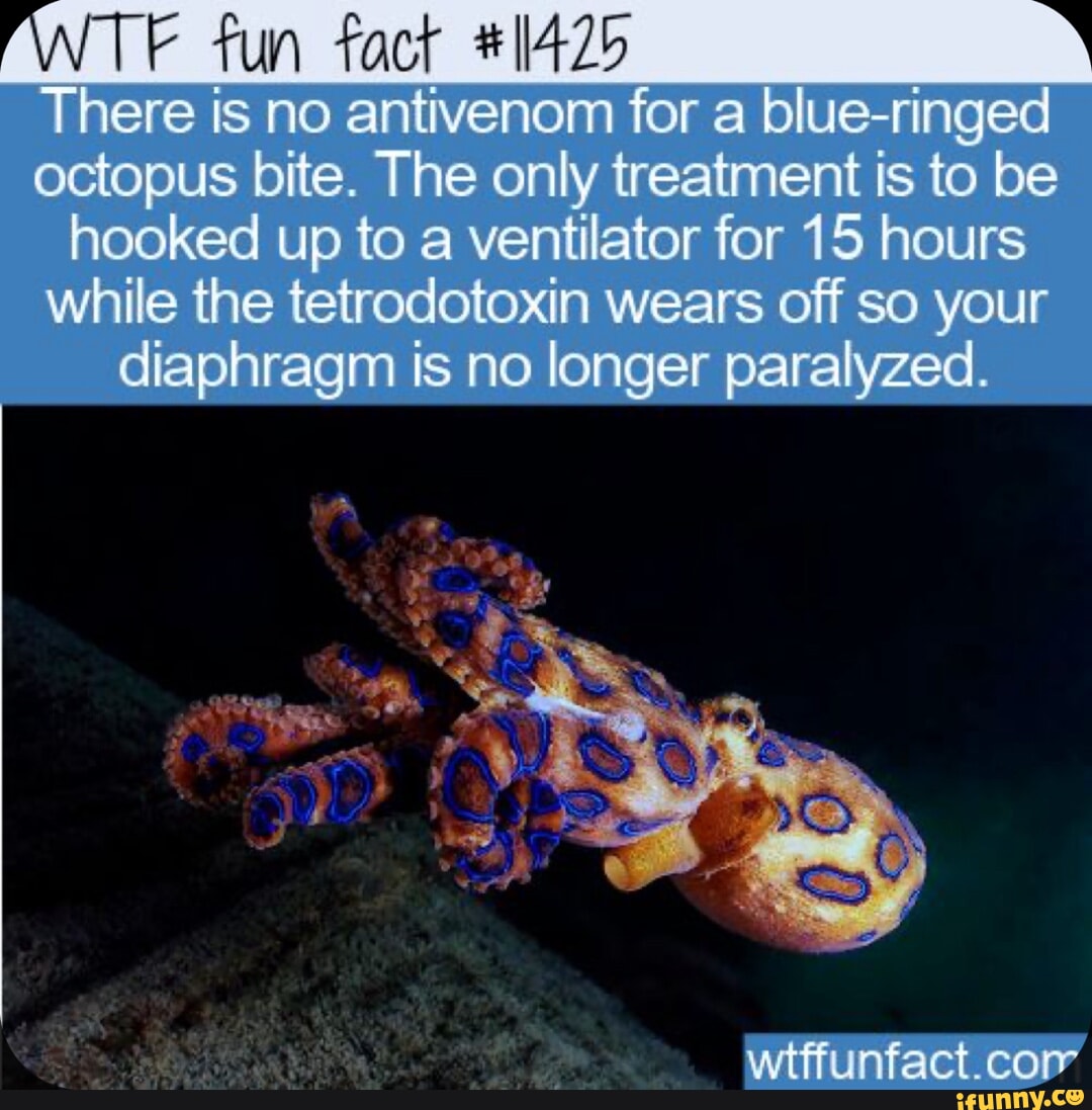 Ventilator memes. Best Collection of funny Ventilator pictures on iFunny