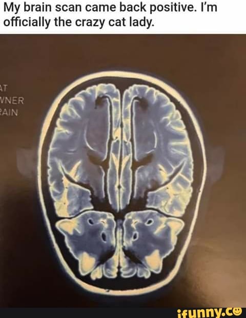 My brain scan came back positive. I'm officially the crazy cat lady ...