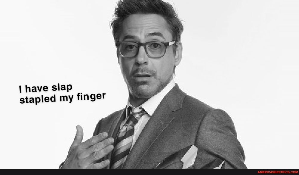 Have slap stapled my finger - America’s best pics and videos
