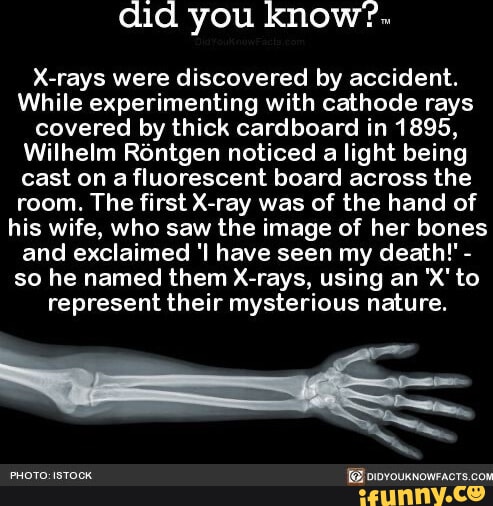 Did you know?. X-rays were discovered by accident. While experimenting ...