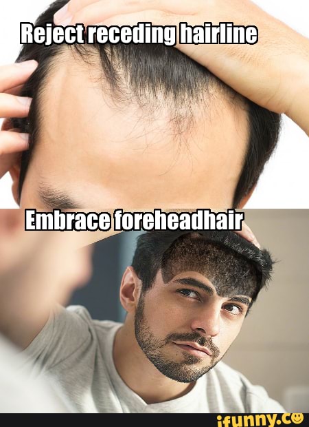 Foreheadhair memes. Best Collection of funny Foreheadhair pictures on ...