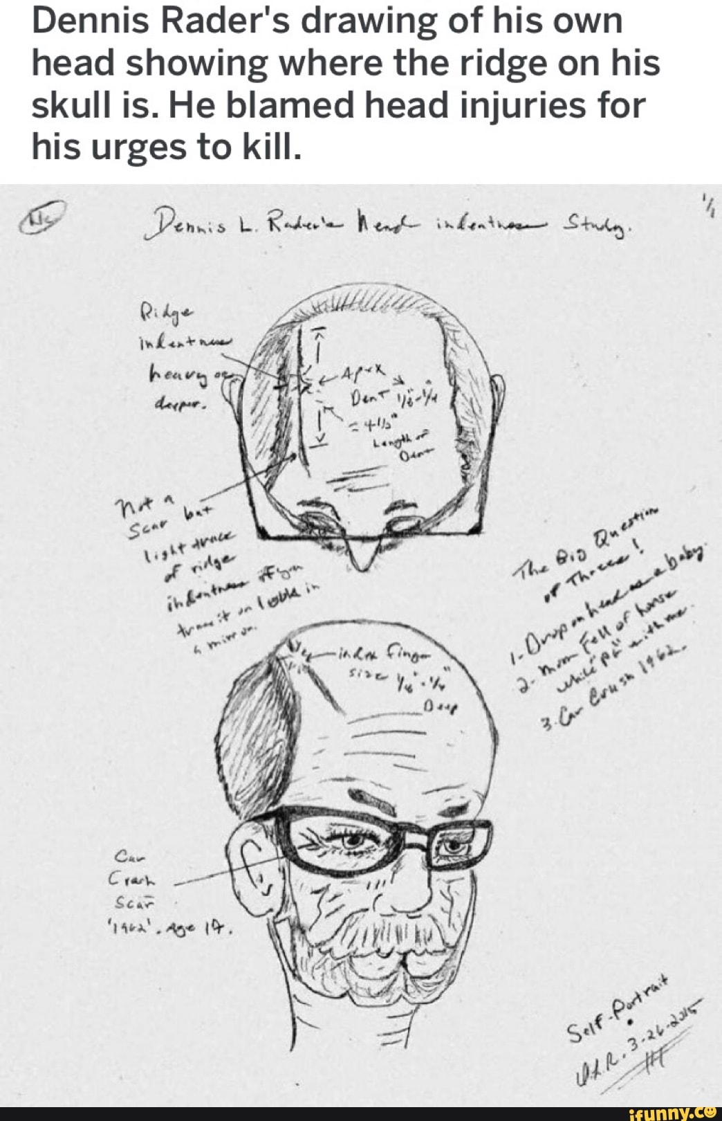 Dennis Rader's drawing of his own head showing where the ridge on his ...
