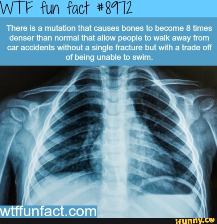 Fracture memes. Best Collection of funny Fracture pictures on iFunny