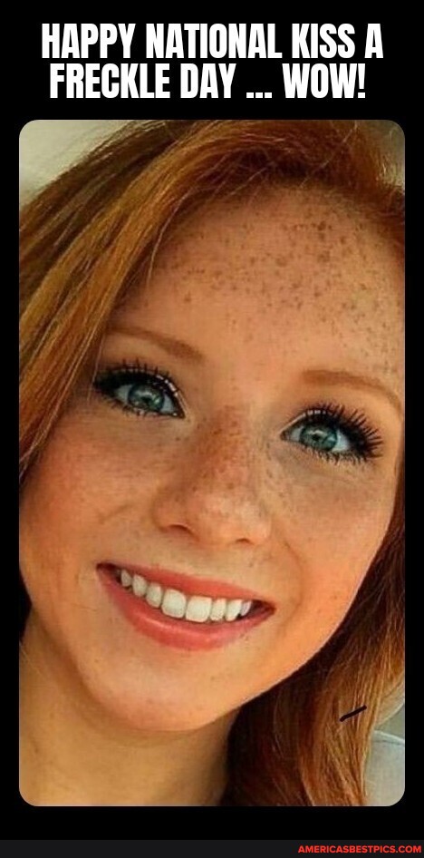 HAPPY NATIONAL KISS A FRECKLE DAY WOW! - America’s best pics and videos